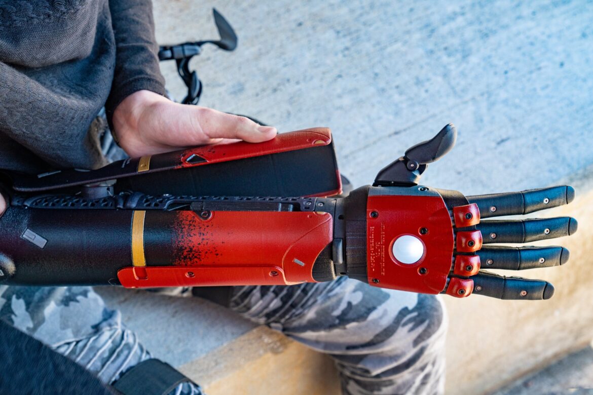 Amputee Becomes Receives The Metal Gear Solid Bionic Arm