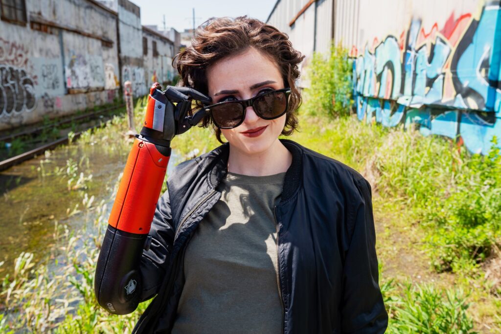 Amputee Becomes Receives The Metal Gear Solid Bionic Arm